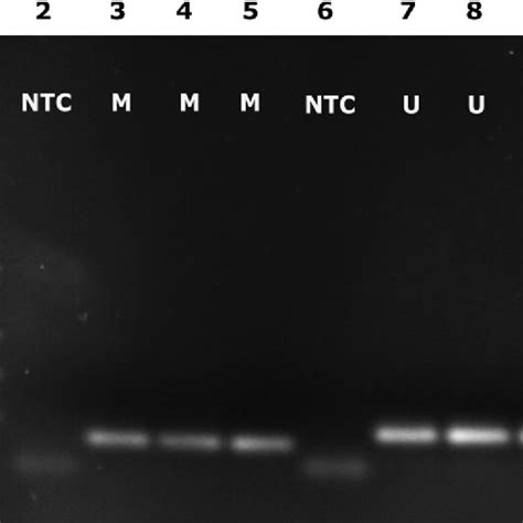 An Example Of Imagej Software Analysis Performed After The Msp