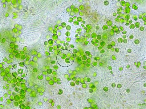 Green Algae Under Microscope Algae Provide New Clues To Cancer
