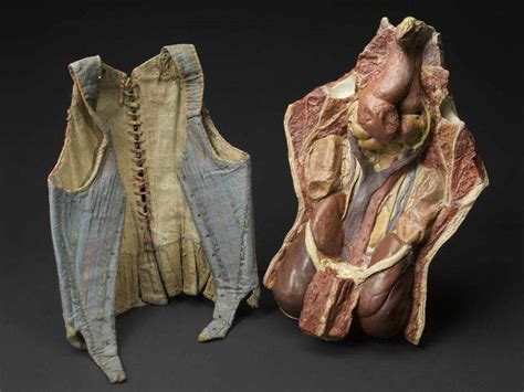 Romanticizing Death Art In The Age Of Tuberculosis