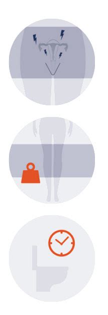 Pelvic Congestion Syndrome Sydney Vascular Surgeon