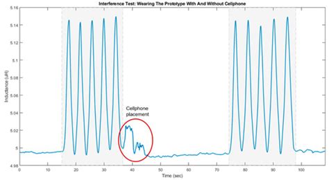 Sensors Free Full Text Wearable Device To Monitor Back Movements Using An Inductive Textile