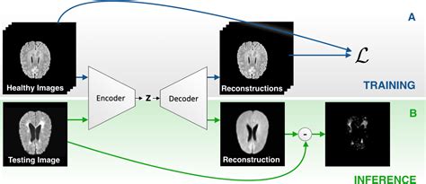 Figure From Anomaly Detection In Brain MRI From Supervised To Unsupervised Deep Learning
