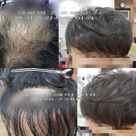 부산증모 부산가발 헤어증모 증모교육 가발교육 붙임머리교육 보톡스증모교육 Band