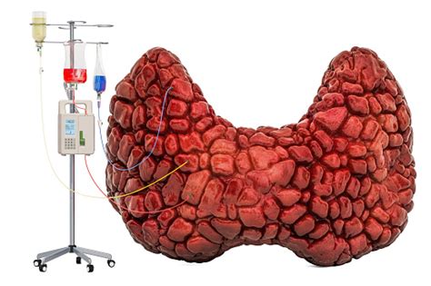 인간 갑 상선 정 맥 치료 시스템 갑 상선 질환의 치료 개념 흰색 배경에 고립 된 3d 렌더링 갑상샘에 대한 스톡 사진 및 기타 이미지 Istock