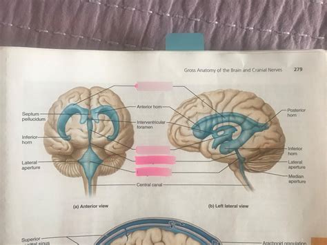 Labeling Csf Fluid Path Diagram Quizlet
