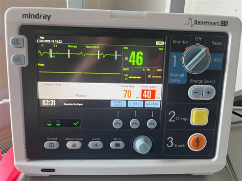 Transcutaneous Pacing Osce Guide External Pacing Geeky Medics
