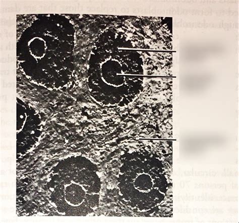 Cross Sectional View Of Dentin Diagram Quizlet
