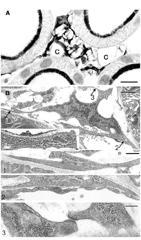 Fibroblasts In The Cortical Peritubular Interstitium A Cryostat Download Scientific Diagram