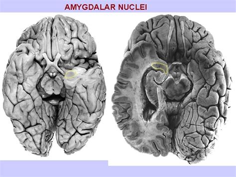 Telencephalic Cortex Nomenclature Paleocortex Archicortex Allocortex