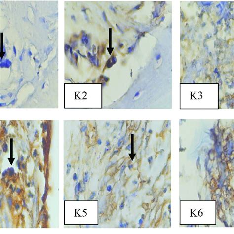 3 The Expression Of Substance P In The Maxillary Section Of Control