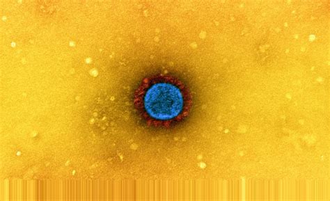 Sarpong Stephen On Linkedin A Transmission Electron Micrograph Of A