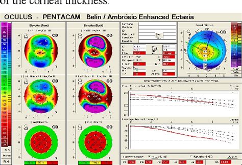 Figure 1 From Keratoconus Detection Algorithm Using Convolutional Neural Networks Challenges