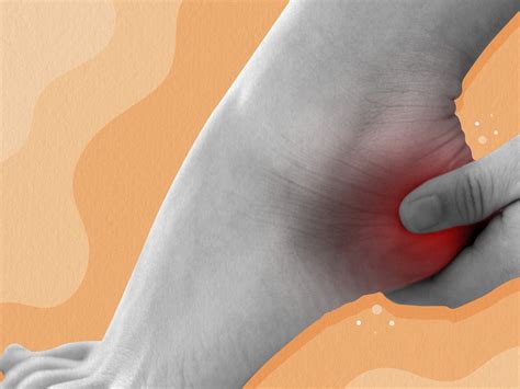 What Is Plantar Fasciitis Symptoms Causes Diagnosis Treatment And