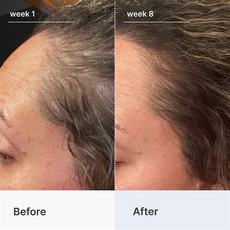 Superpower Advanced Hair Densifying Scalp Serum Bny