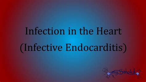 Infective Endocarditis My Stroke