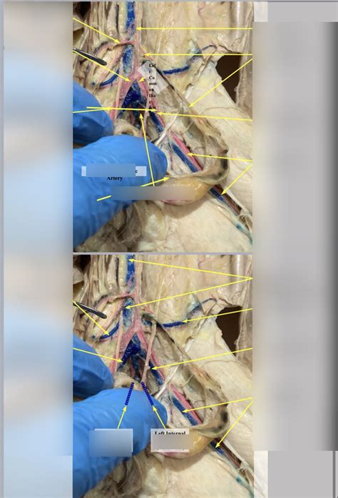 LAB PRACTICAL 2 3 Diagram Quizlet