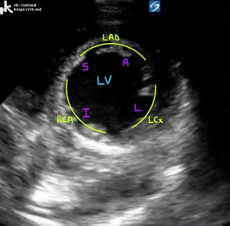Cardiac Transthoracic Echocardiography Tte Summary And Labeled Views Rk Md