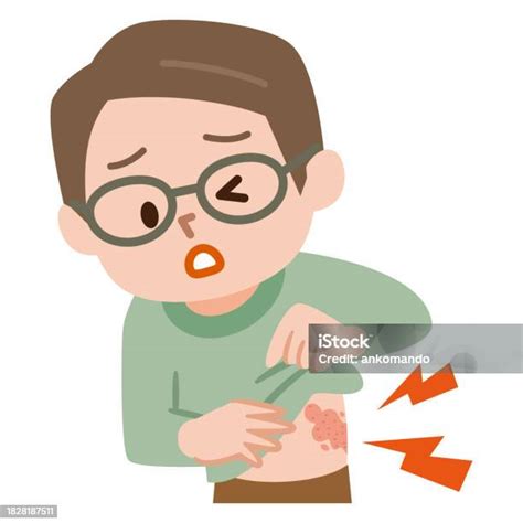 Vector Illustration Of The Symptoms Of Shingles Stock Illustration