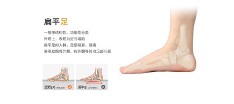 足部健康知识