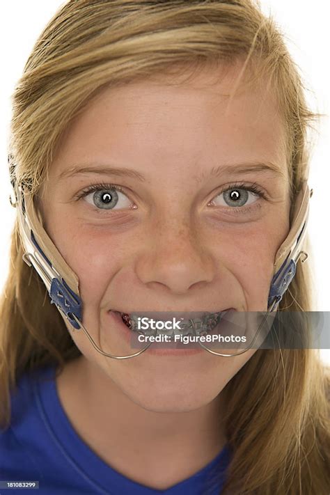 Tween 여자아이 교정 Headgear 12 13세에 대한 스톡 사진 및 기타 이미지 12 13세 14 15 살 미소 Istock