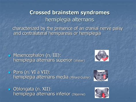 Clinical Neurological Syndroms Ppt Download