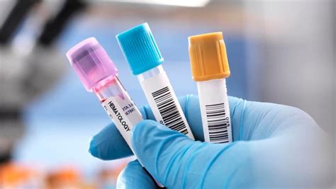 Normal Hemoglobin Levels And Ranges Forbes Health