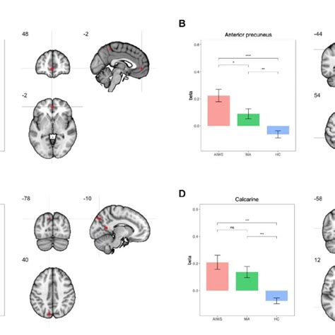 Results Of The Seed To Voxel Thalamo Cortical Connectivity Analysis