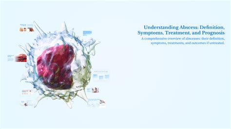 Understanding Abscess Definition Symptoms Treatment And Prognosis