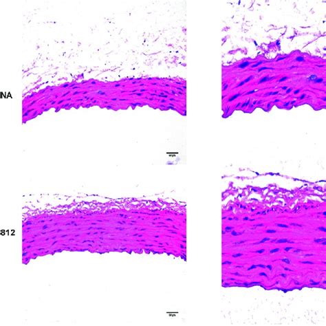 Detected By He Atherosclerotic Lesion Was Improved By Tcons 00034812 Download Scientific