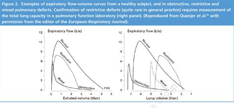 Examples Of Fixed Large Airway Obstruction Left Variable Large