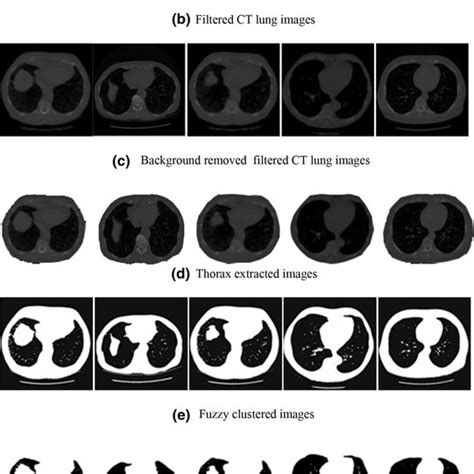 The Proposed Optimal Lung Nodules Detection Sequences Download Scientific Diagram