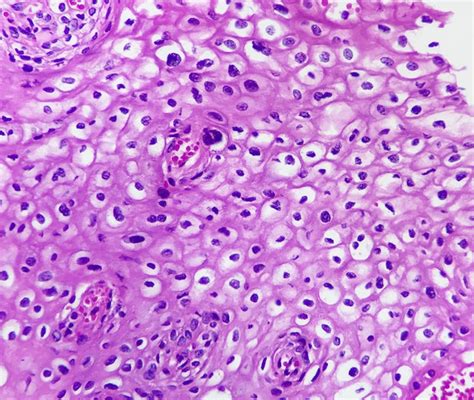 7 Cytopathic Effect Royalty Free Photos And Stock Images Shutterstock