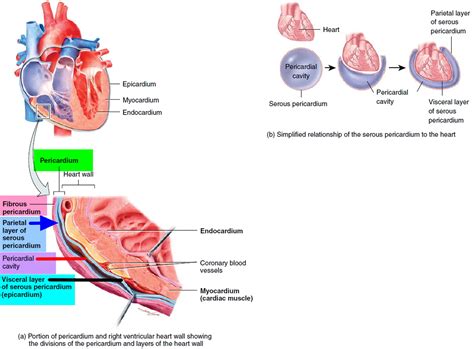 Pericardial Effusion Causes Symptoms Diagnosis Prognosis Treatment