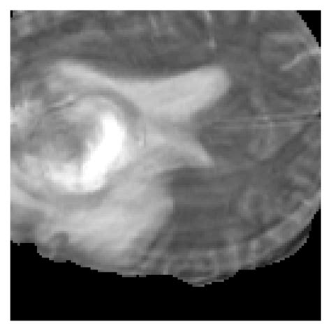 Visualization Of Federated Segmentation From Left To Right Input Download Scientific Diagram