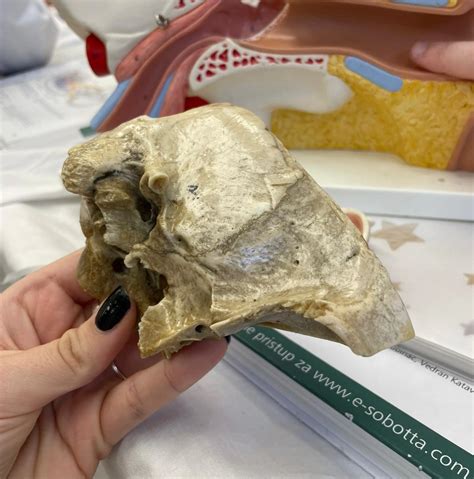 Temporal Bone Anatomy And Clinical Perspectives Medbrane