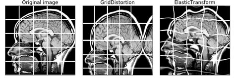 Albumentations · Pypi