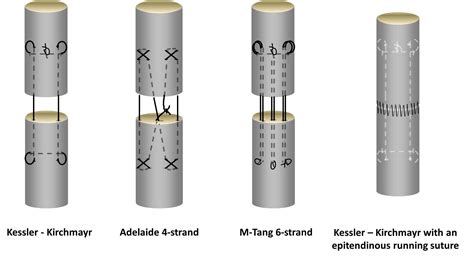 politetrafluoroetileno ptfe como material de sutura en cirugía de