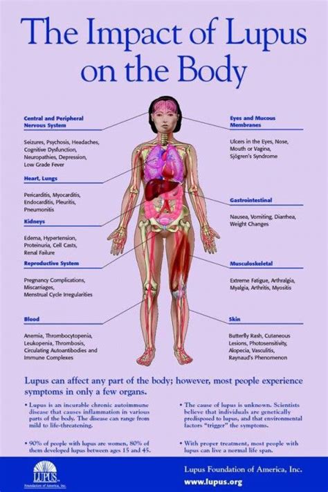 Pin On Autoimmune