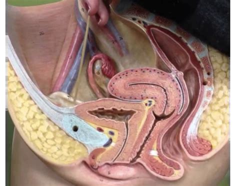 Female Reproductive System Model Internal Quiz