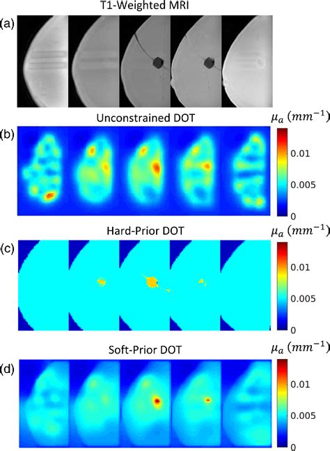 Hybrid Time Domain And Continuous Wave Diffuse Optical Tomography Instrument With Concurrent