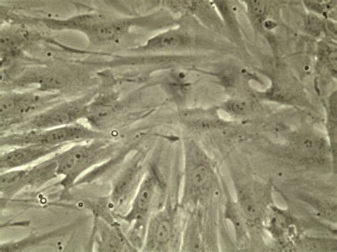 How Can We Remove Fibroblasts From Primary Keratinocyte Cultures Researchgate
