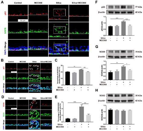 Effects Of Silica Induced Nlrp3 Inflammasome Activation On Basal Cell