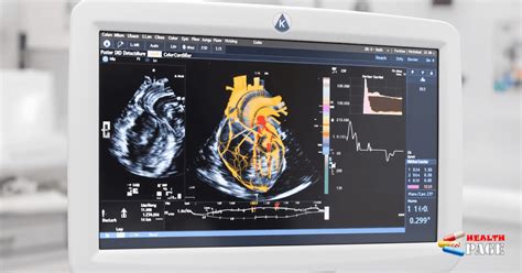 Cpt Code 93306 Explained Echocardiogram Billing And Coding