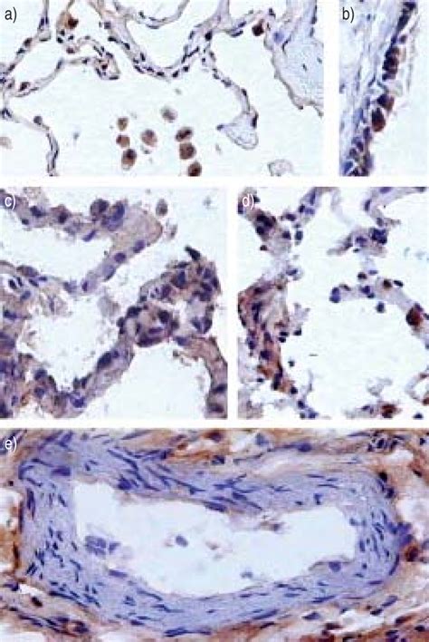 Representative Immunoperoxidase Staining For Vascular Endothelial