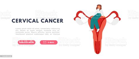 자궁 경부암 개념입니다 질병 증상 Hpv 감염 개발 평면 벡터 그림 자궁내막증에 대한 스톡 벡터 아트 및 기타 이미지 자궁내막증 사람들 사람유두종바이러스 Istock