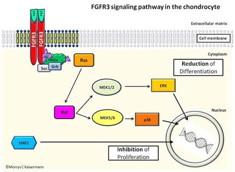 Fgfr3 Mutation Achondroplasia