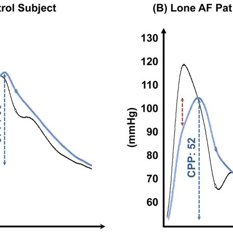 Examples Of Peripheral And Central Pulse Waveforms A Waveforms From Download Scientific