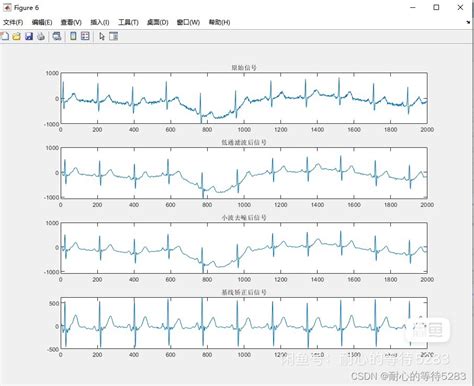 【ecg去噪】ecg去噪，使用低通滤波和小波分解结合程序dae Ecg去噪 Csdn博客
