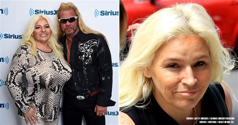 Beth Chapman Before And After