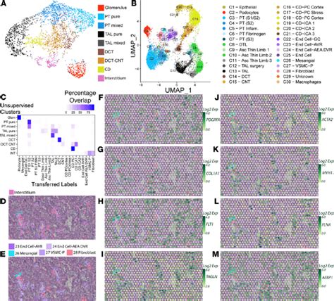 Transfer Of Single Nuclei Rna Sequencing Clusters To The Human Spatial